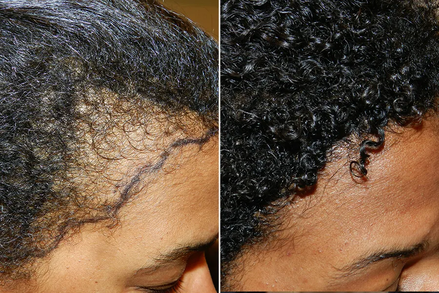 Dr. John Diep Hair Transplant - Natural Hair Restoration Experts